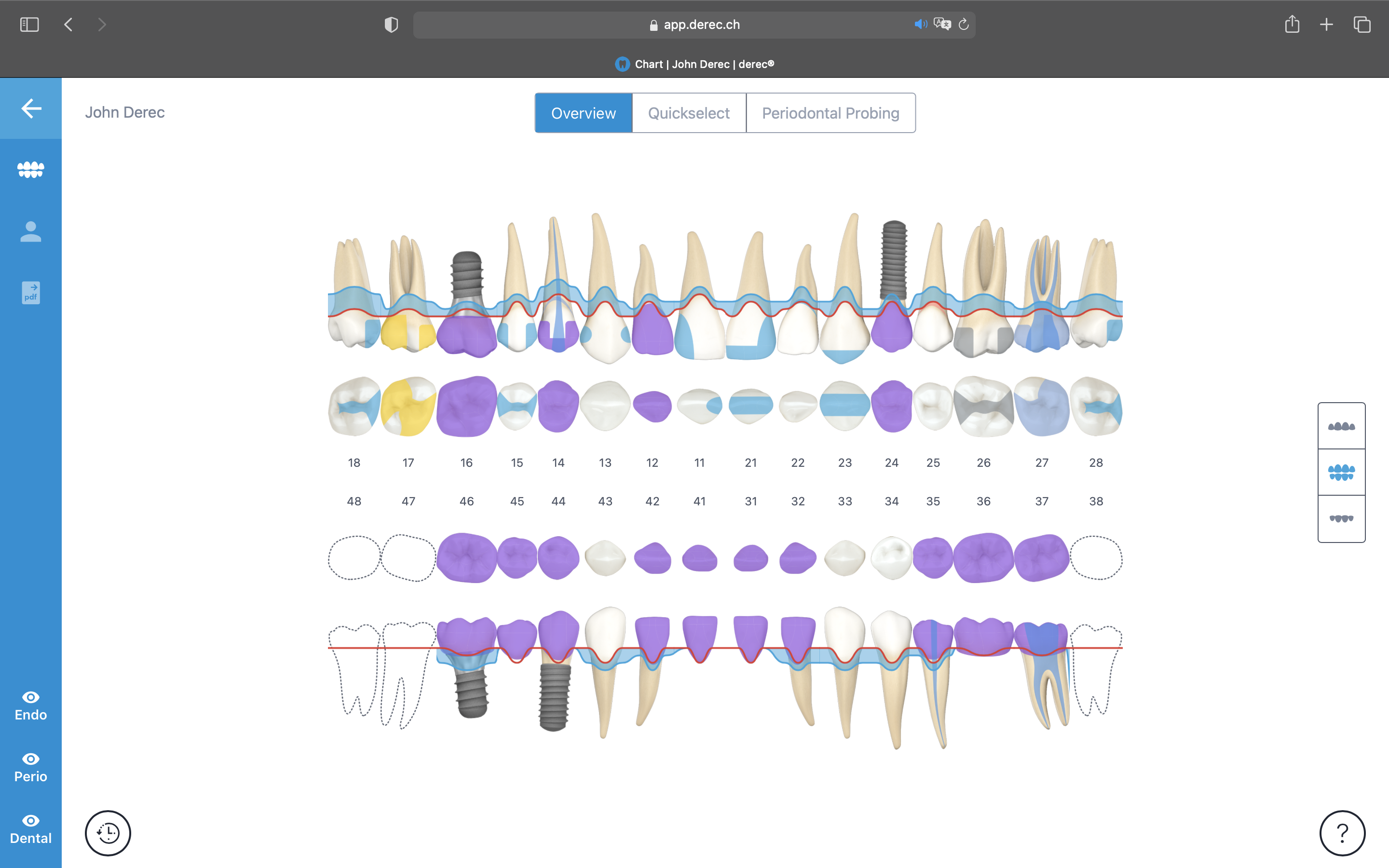 Periodontal Chart Online Derec Online Dental Charting